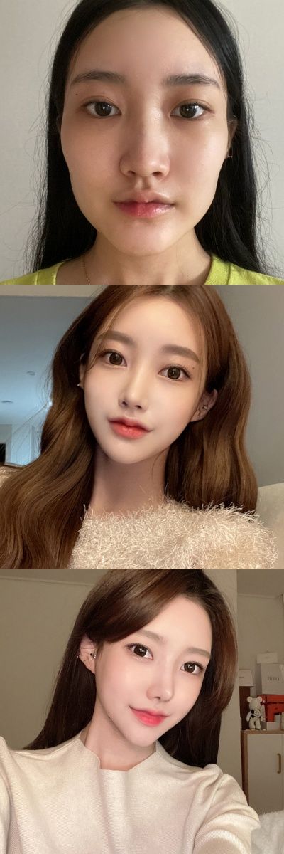 예쁘면 DA야! 디에이성형외과💗